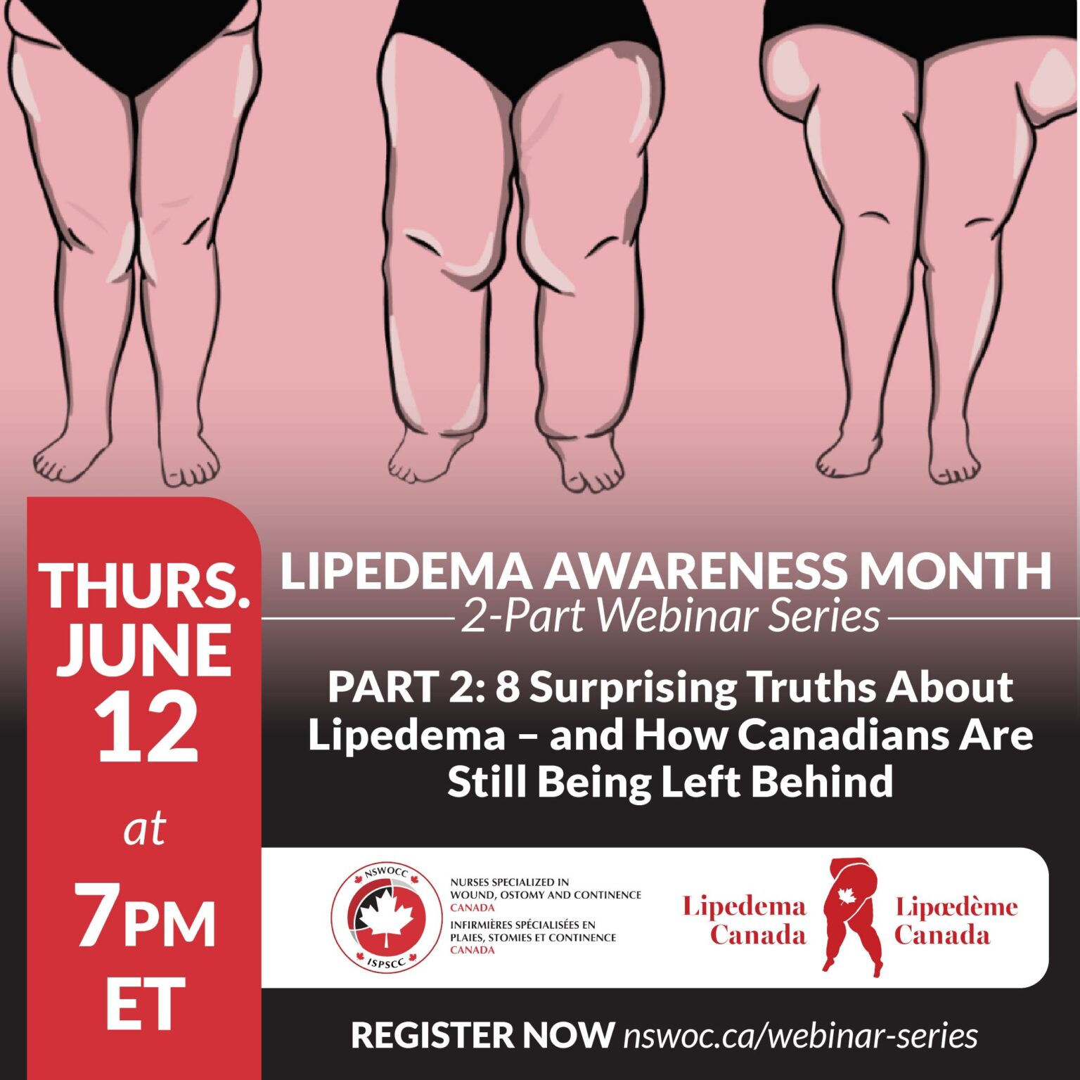 Lipedema Canada: Open Minds Change Lives
